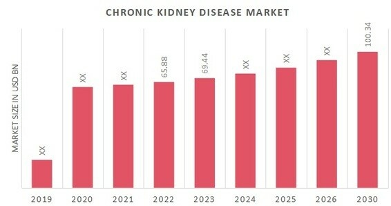Chronic Kidney Disease Market Research, Size | Industry Forecast To 2030